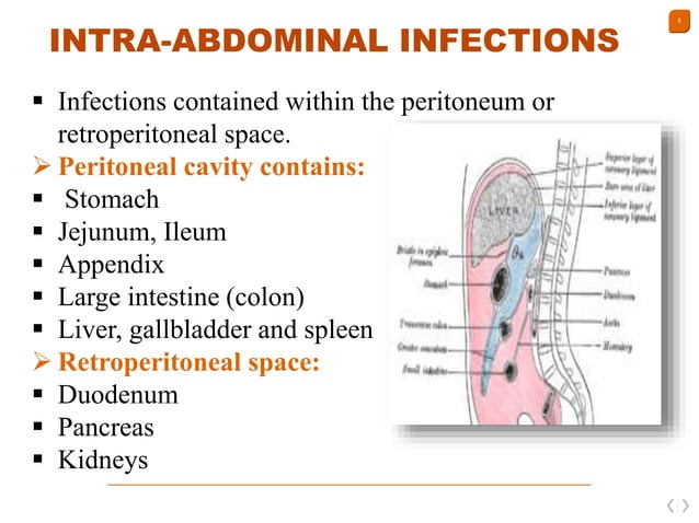 Intra-abdominal infections | PPTX | Digestive Disorders | Diseases and Conditions
