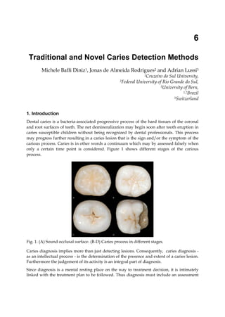 InTech-Traditional_and_novel_caries_detection_methods.pdf