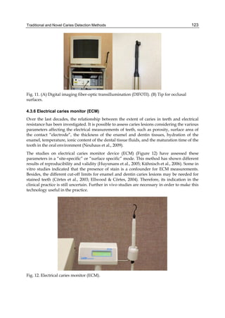 InTech-Traditional_and_novel_caries_detection_methods.pdf