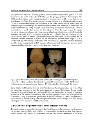 InTech-Traditional_and_novel_caries_detection_methods.pdf