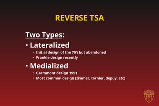 Integra_-_Reverse_Total_Shoulder_Arthroplasty.ppt