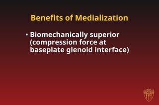 Integra_-_Reverse_Total_Shoulder_Arthroplasty.ppt