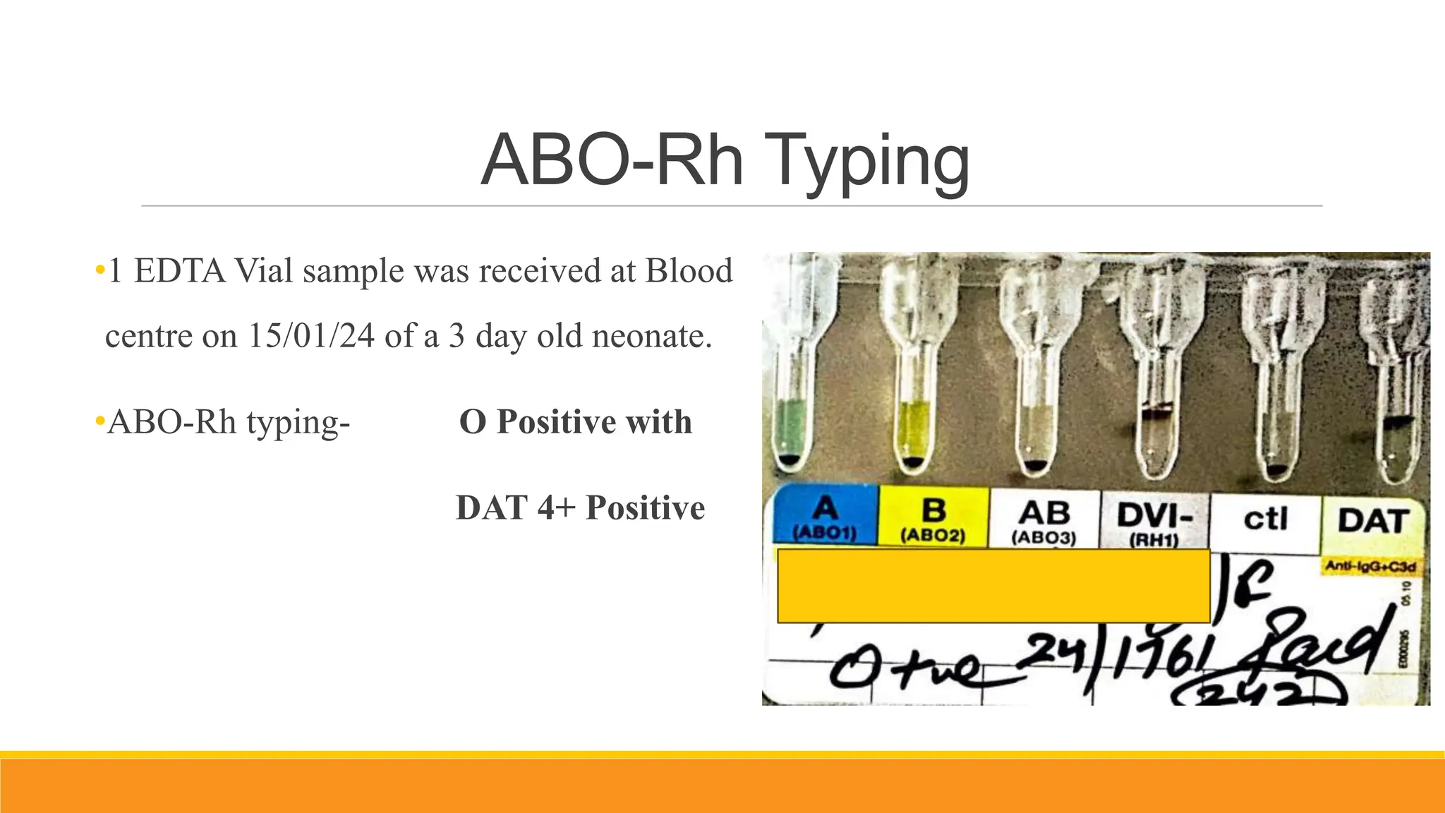 A case presentation of Exchange Transfusion in new born infant with ...