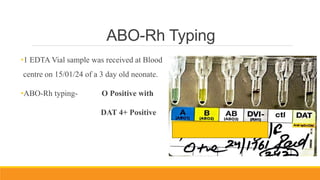 A case presentation of Exchange Transfusion in new born infant with ...