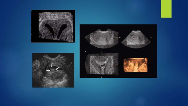 Integrated approach to infertility work up | PPTX