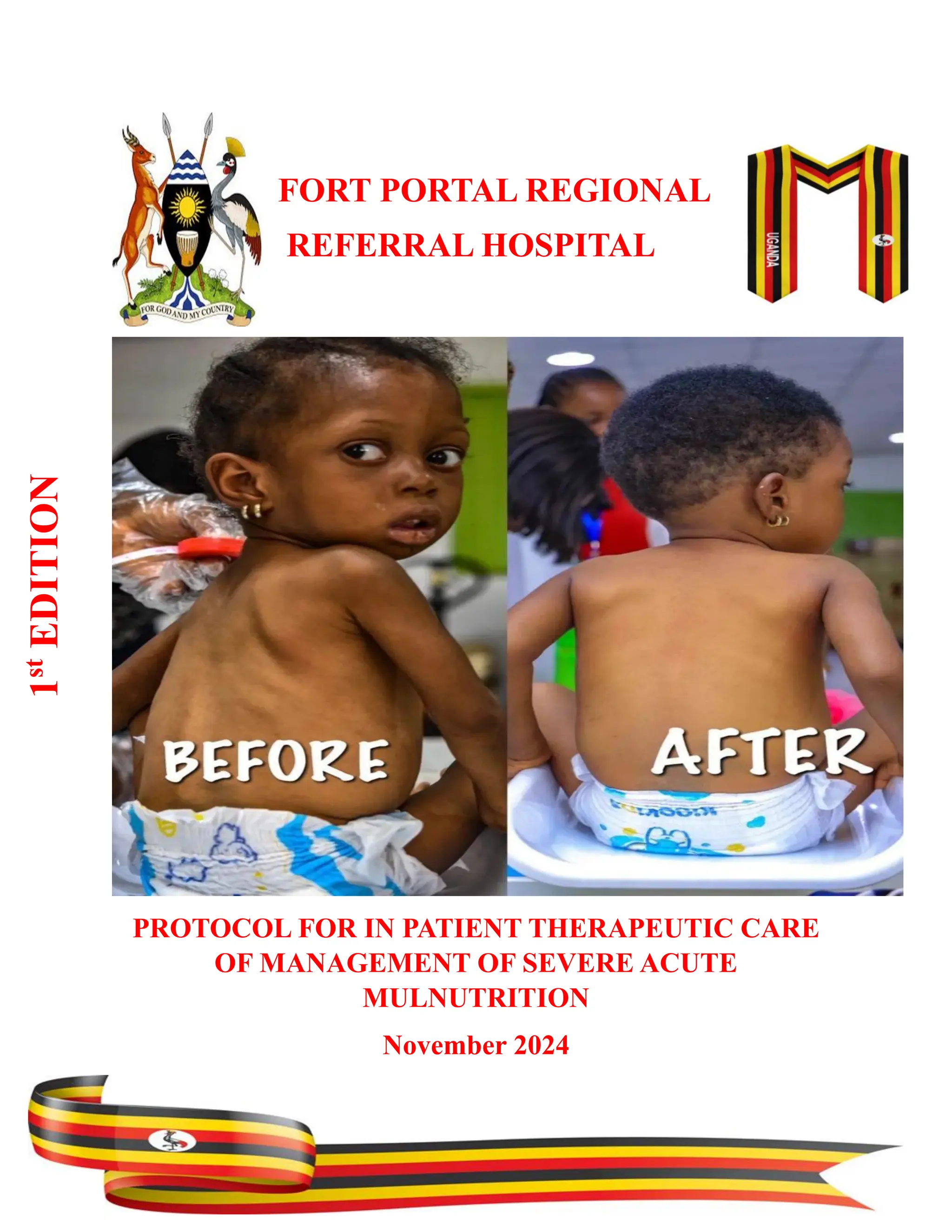 INTEGRATED MANAGEMENT OF ACUTE MALNUTRITION (IMAM) 1st EDITION NOVEMBER ...
