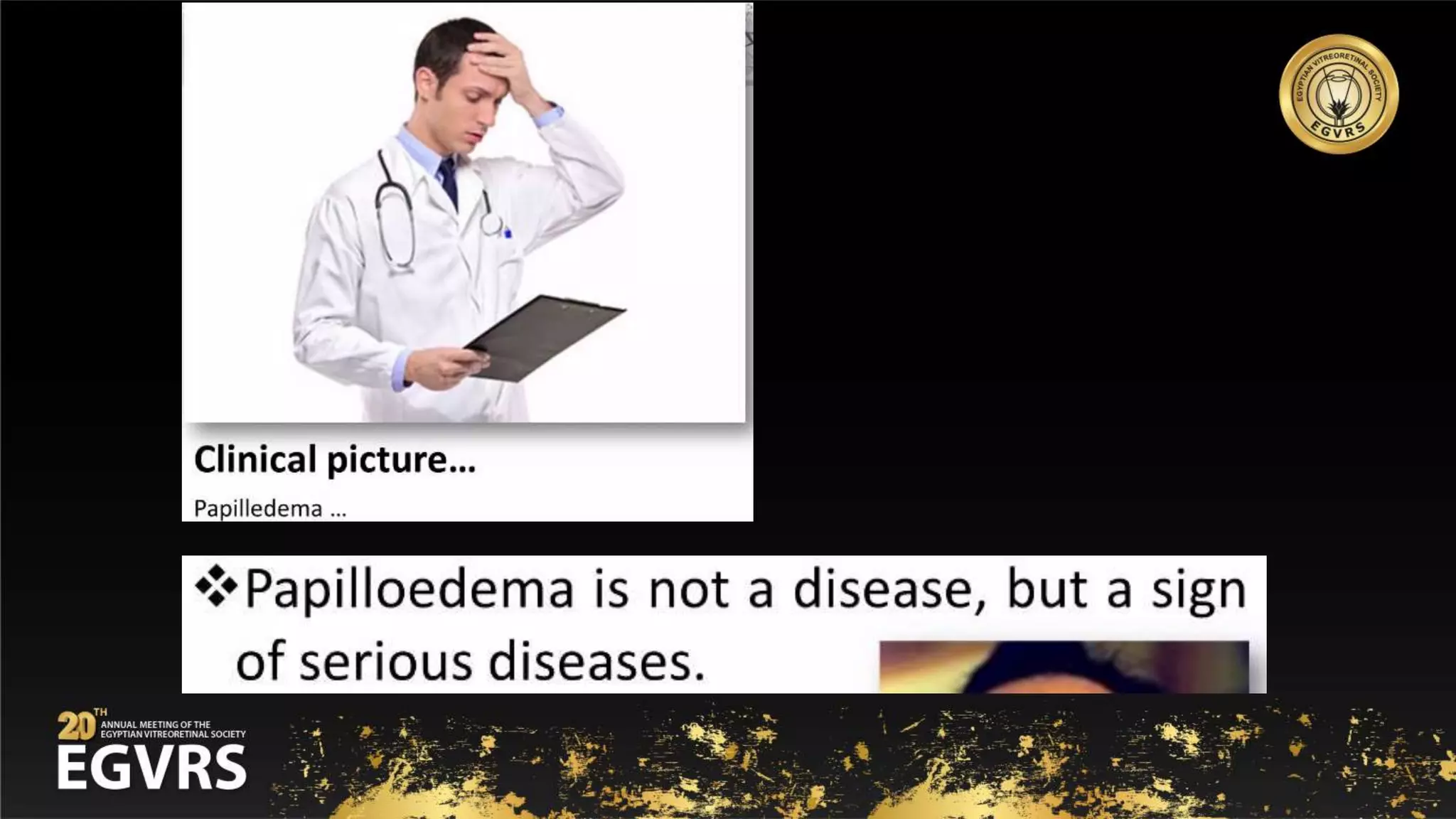 integrated optic nerve.pptx