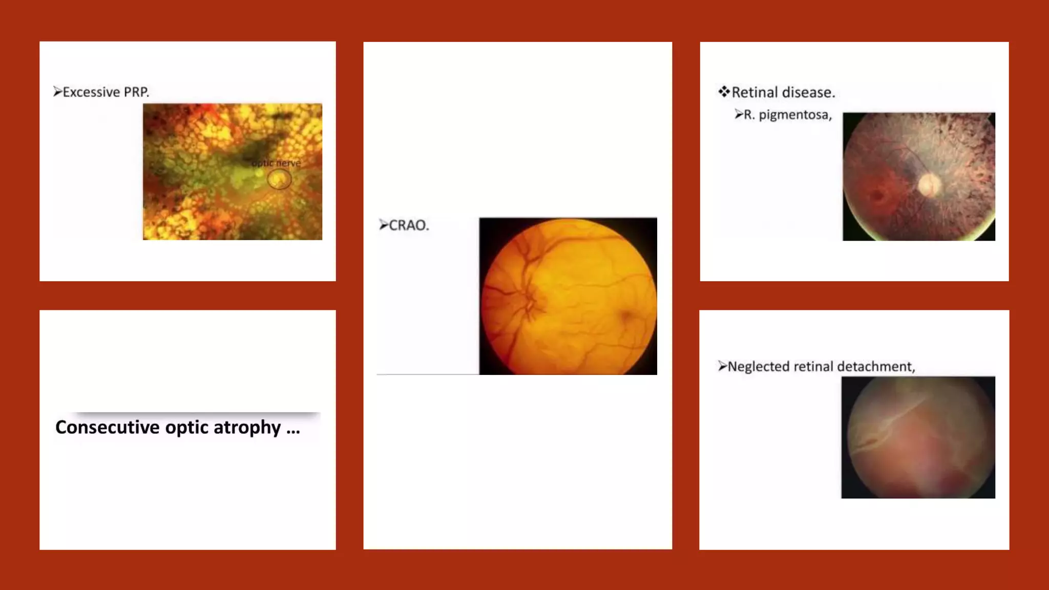 integrated optic nerve.pptx