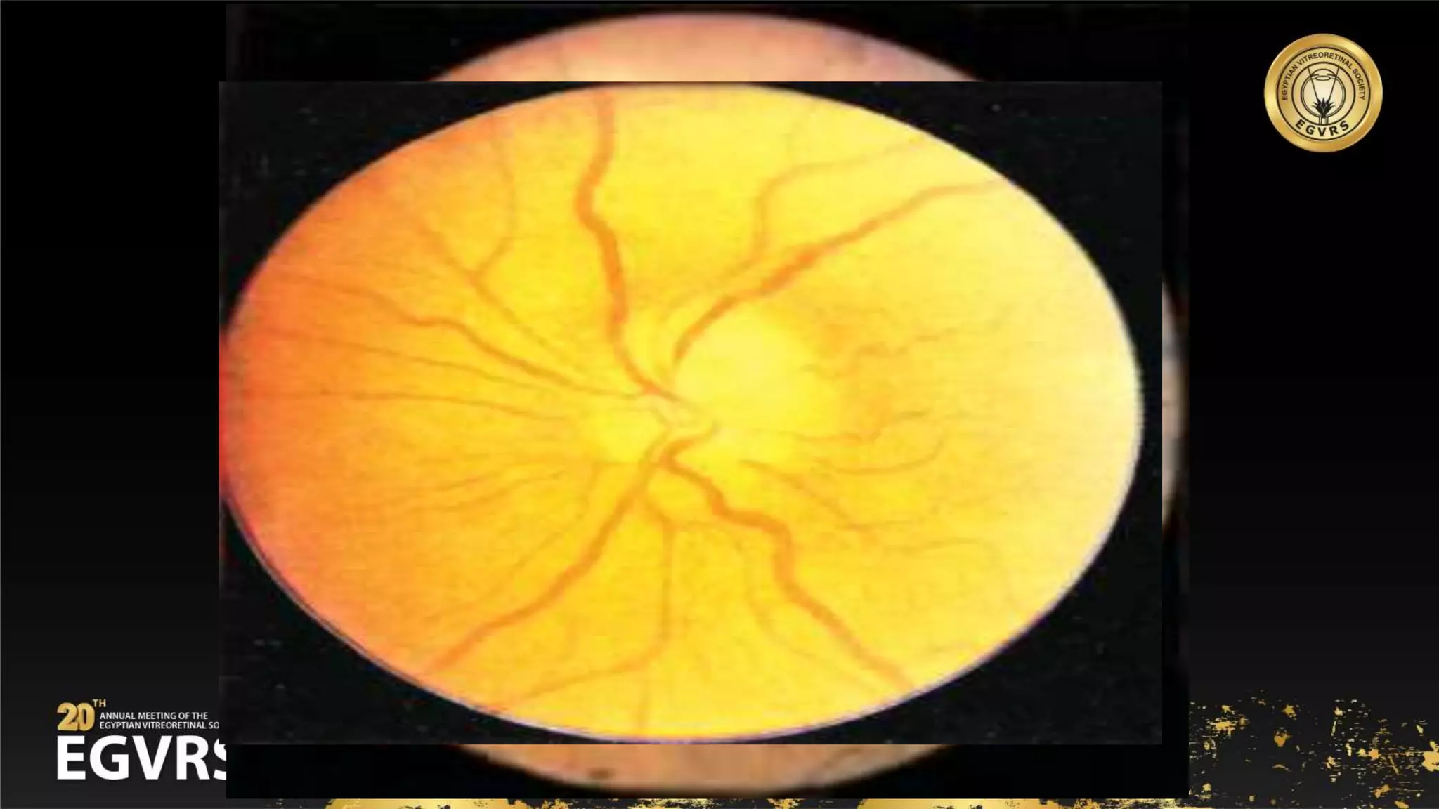 integrated optic nerve.pptx