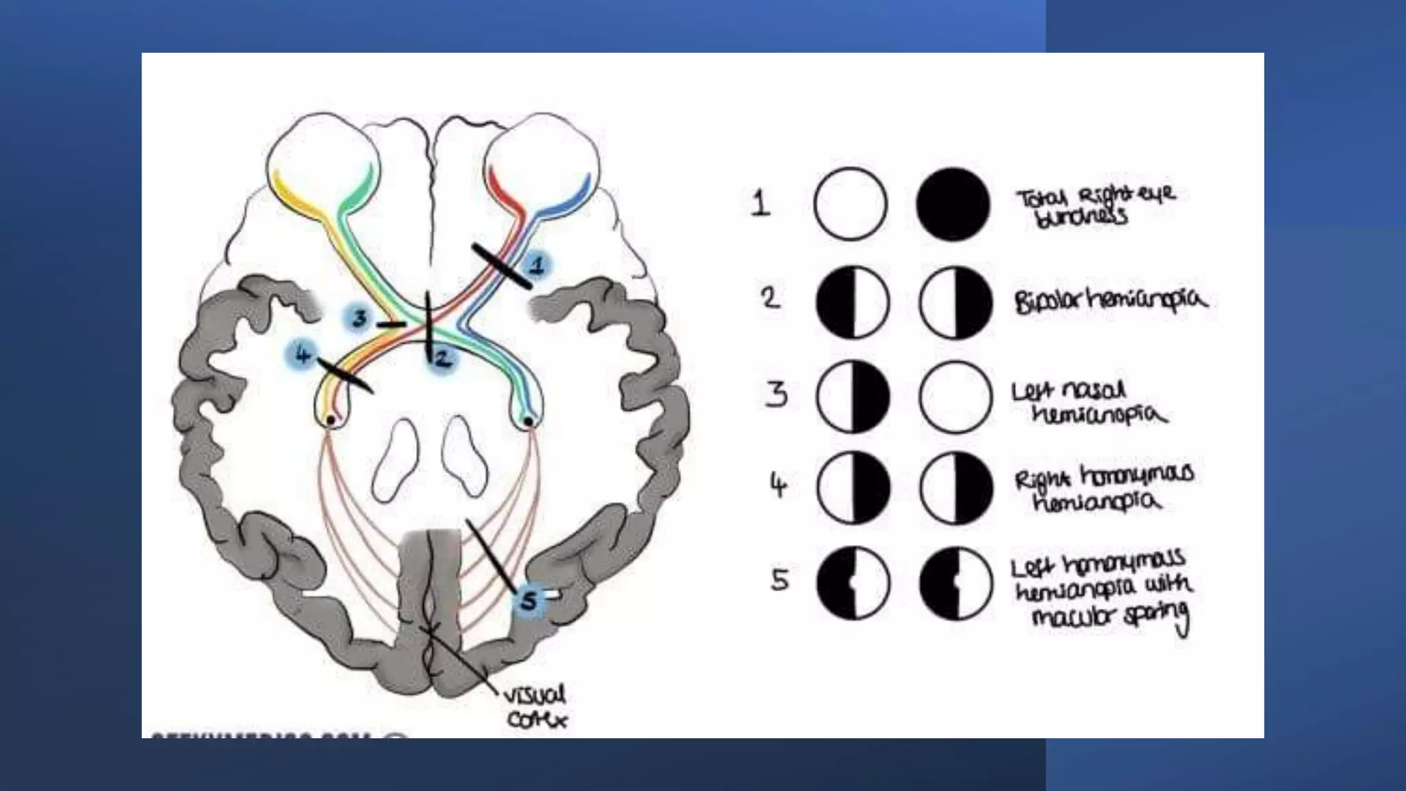 integrated optic nerve.pptx