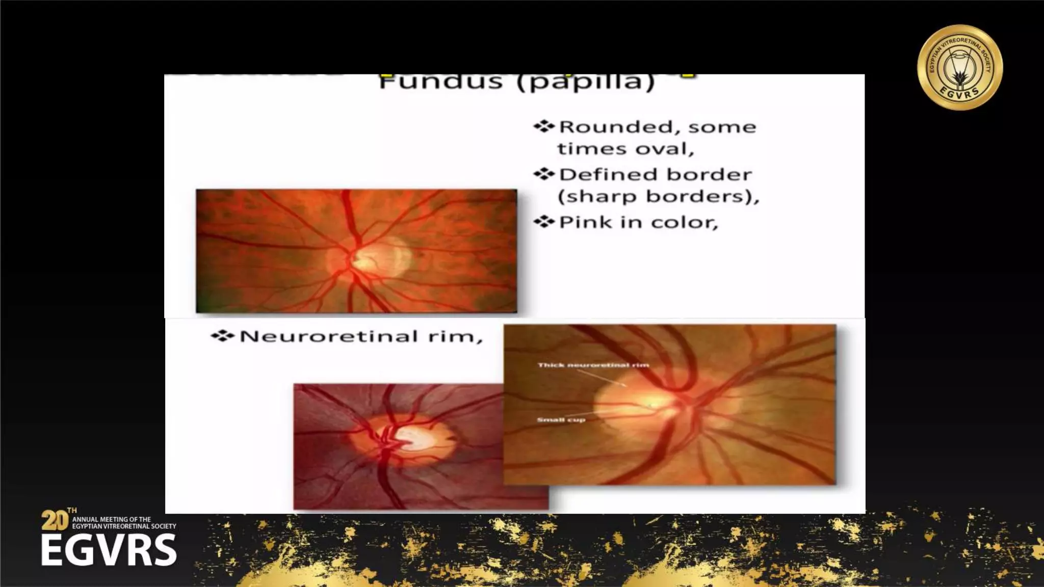 integrated optic nerve.pptx