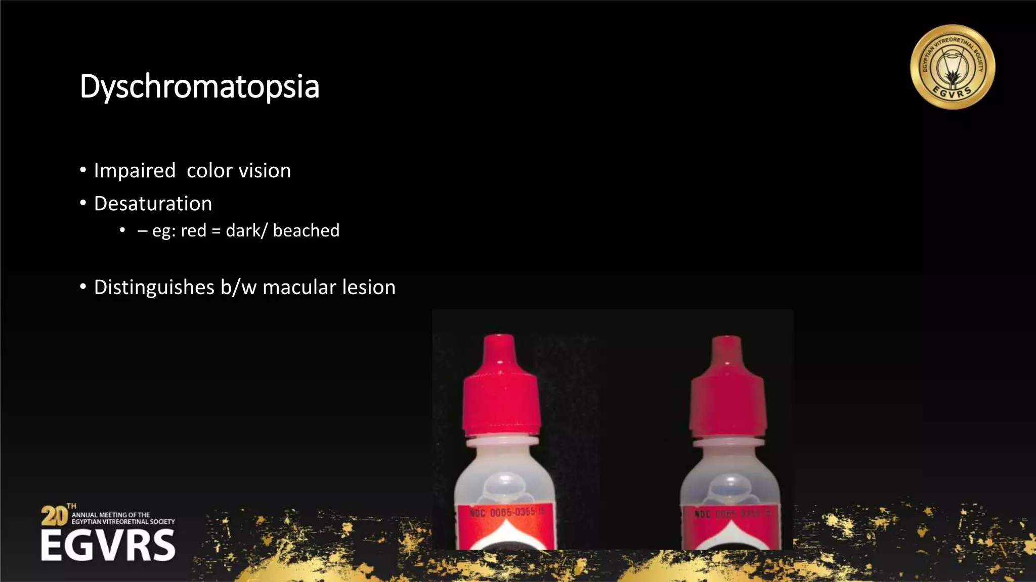 integrated optic nerve.pptx
