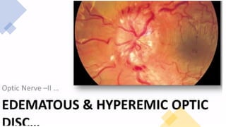 integrated optic nerve.pptx