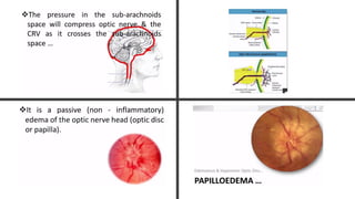 integrated optic nerve.pptx
