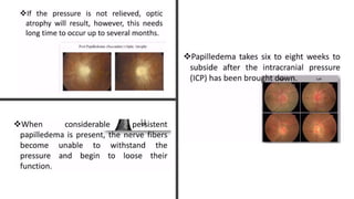 integrated optic nerve.pptx