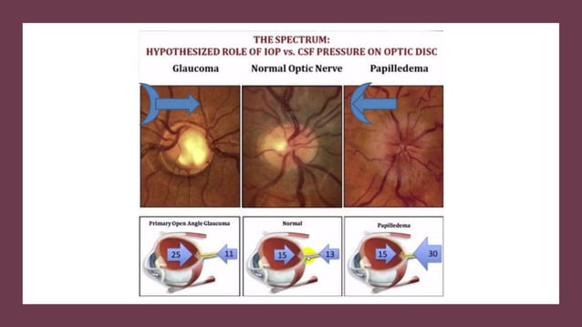 integrated optic nerve.pptx