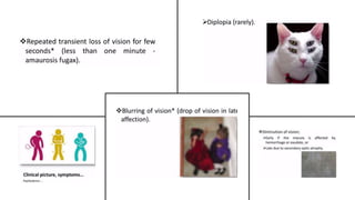 integrated optic nerve.pptx