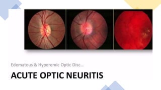 integrated optic nerve.pptx