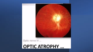integrated optic nerve.pptx