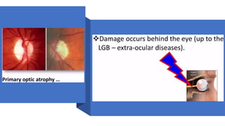 integrated optic nerve.pptx