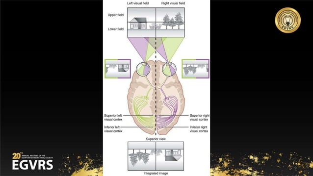 integrated optic nerve.pptx