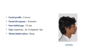 INTEGRATED SUPERNUMERARY TEETH.pptx POWER POINT | PPTX