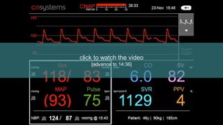 Integrating Noninvasive Blood Pressure Monitoring with Human Physiology ...