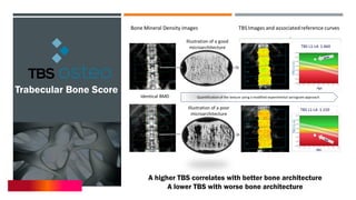 Integrating TBS Into Your Clinical Practice.pdf