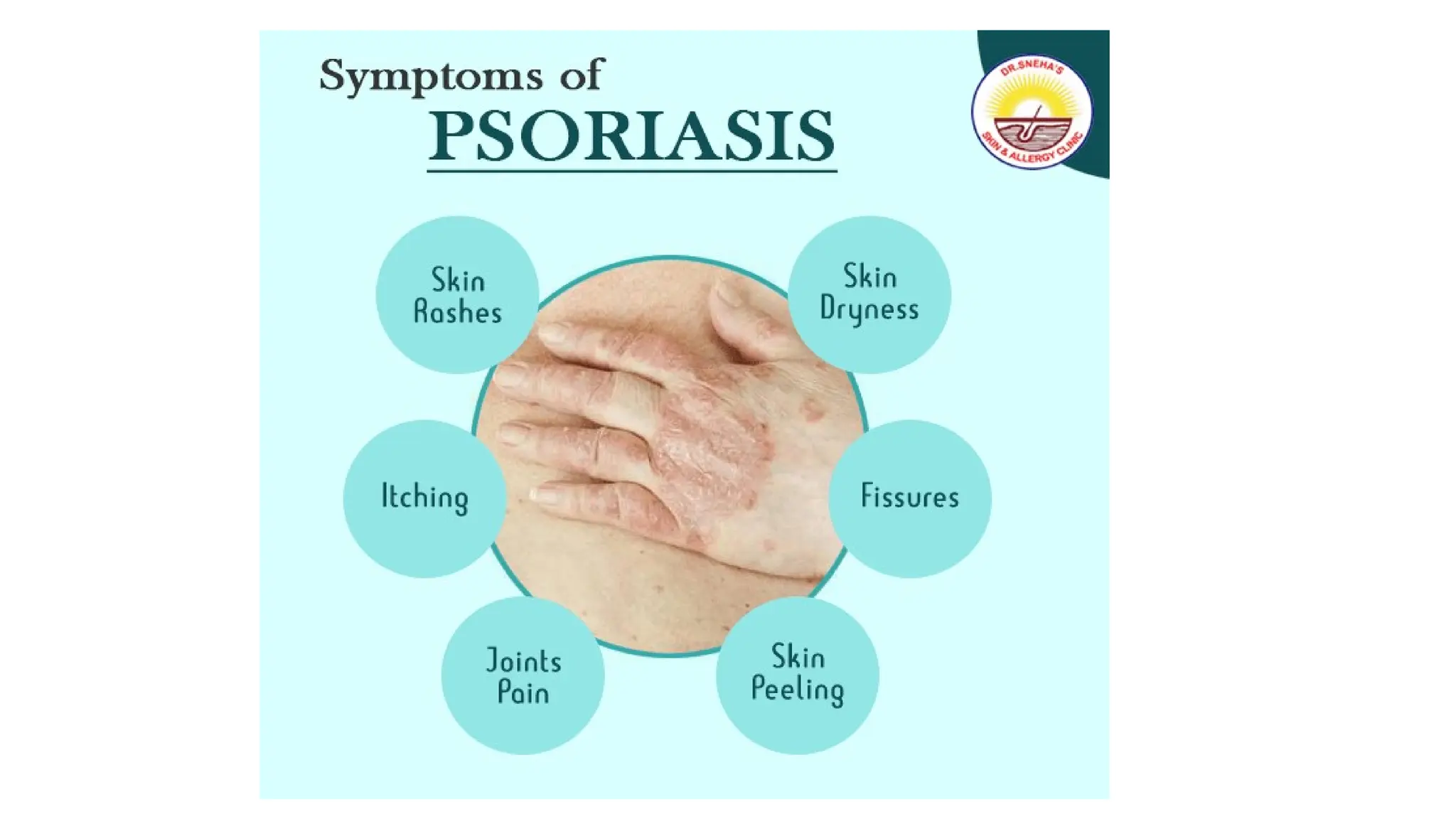 Integumentary disorder / skin disease , its clinical manifestation and ...