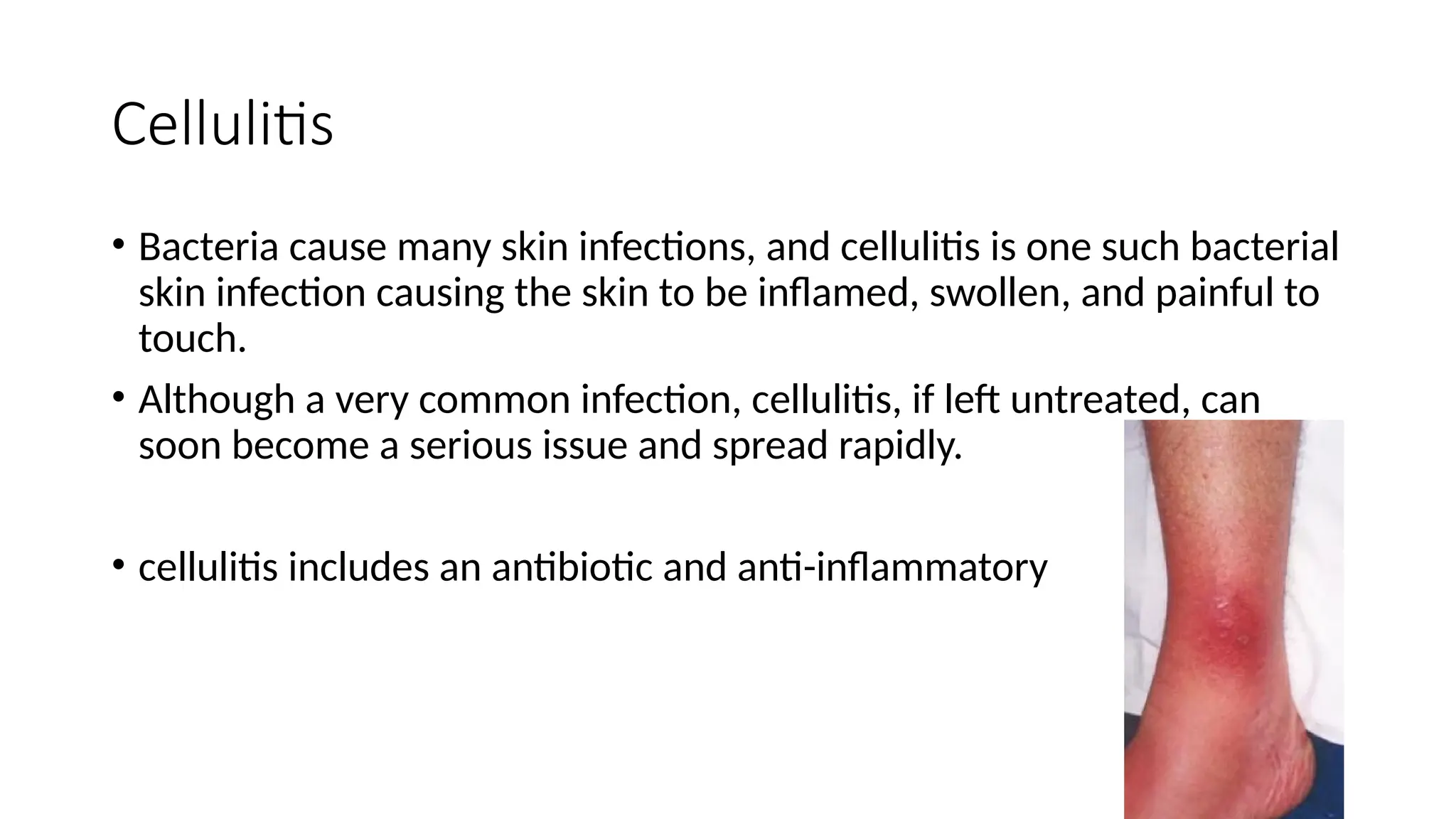 Integumentary disorder / skin disease , its clinical manifestation and ...
