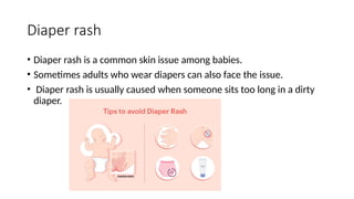 Integumentary disorder / skin disease , its clinical manifestation and ...