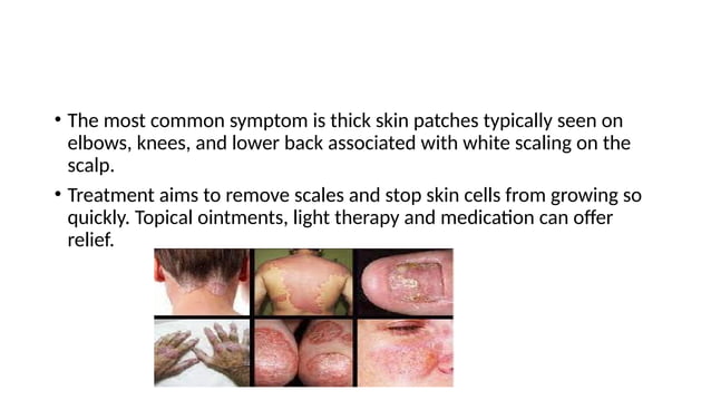Integumentary disorder / skin disease , its clinical manifestation and ...