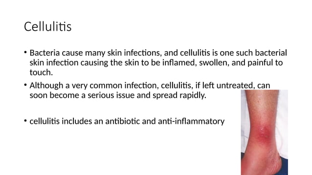 Integumentary disorder / skin disease , its clinical manifestation and ...