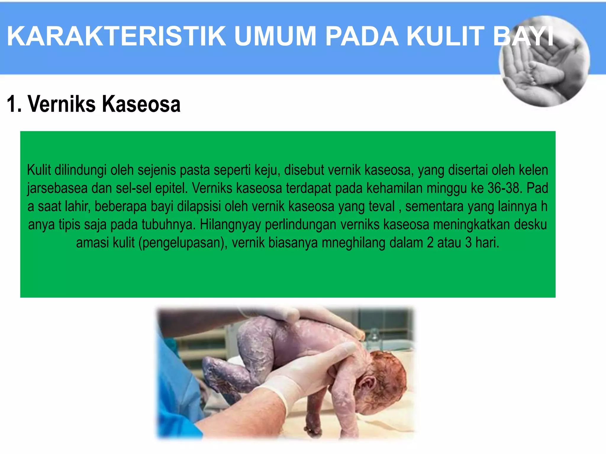 Adaptasi BBL pada Sistem Integumen (Patologis) | PPTX