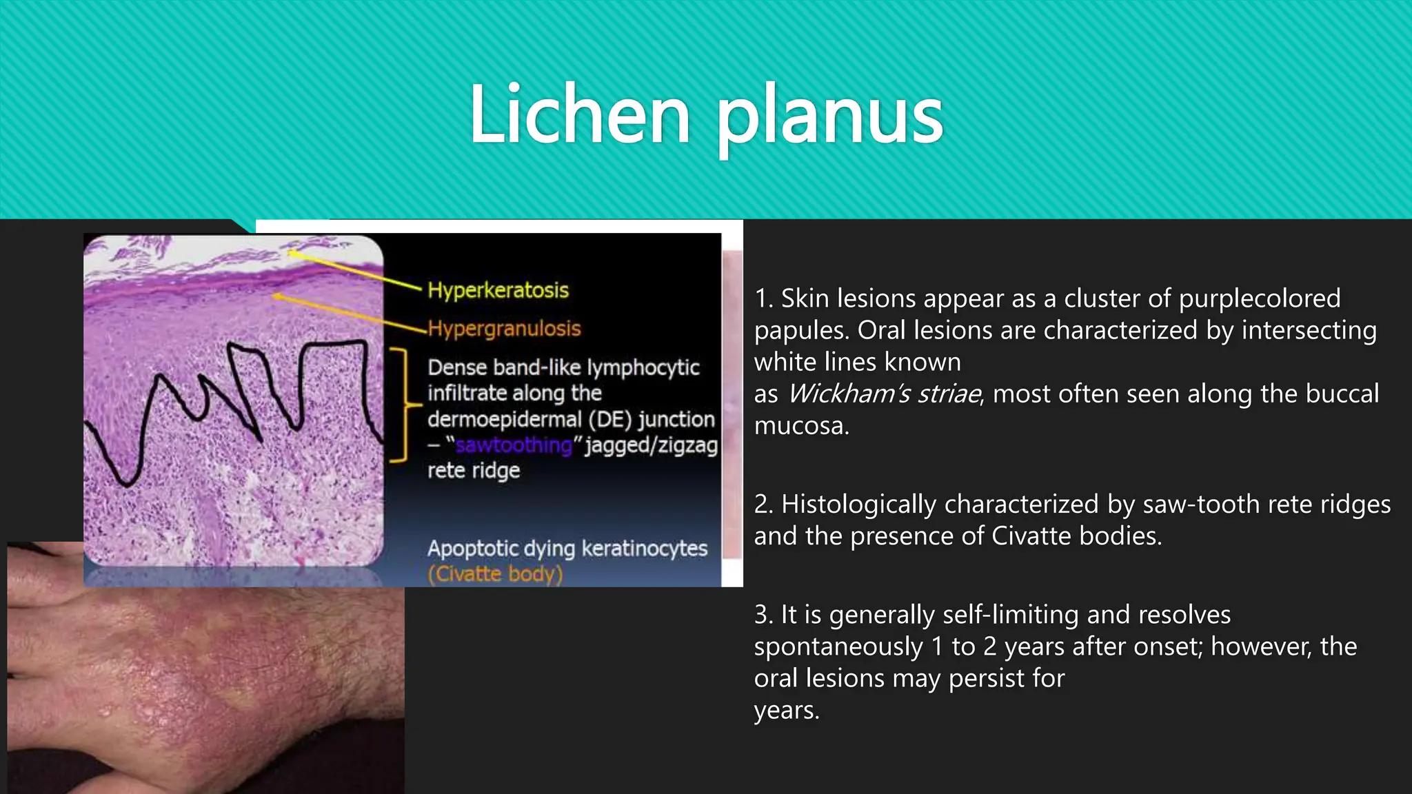 INTEGUMENTARY SYSTEM.pptx