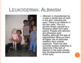 Med. Terminology Presentation: Ch.3, Integumentary System | PPTX