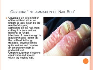Med. Terminology Presentation: Ch.3, Integumentary System | PPTX