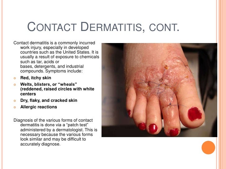Med. Terminology Presentation: Ch.3, Integumentary System