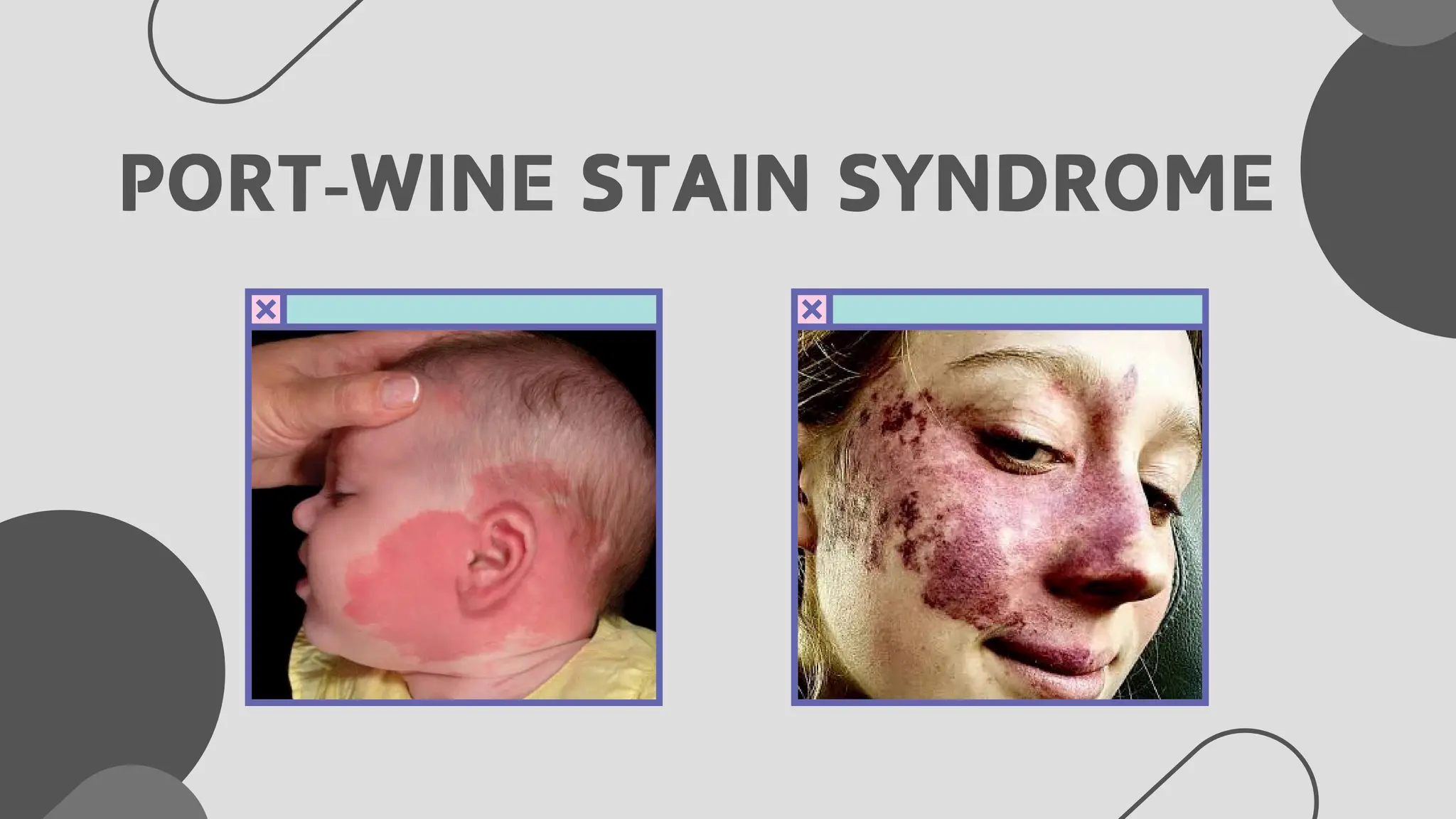 INTEGUMENTARY-SYSTEM-DEVELOPMENTAL-DEFECTS.pdf