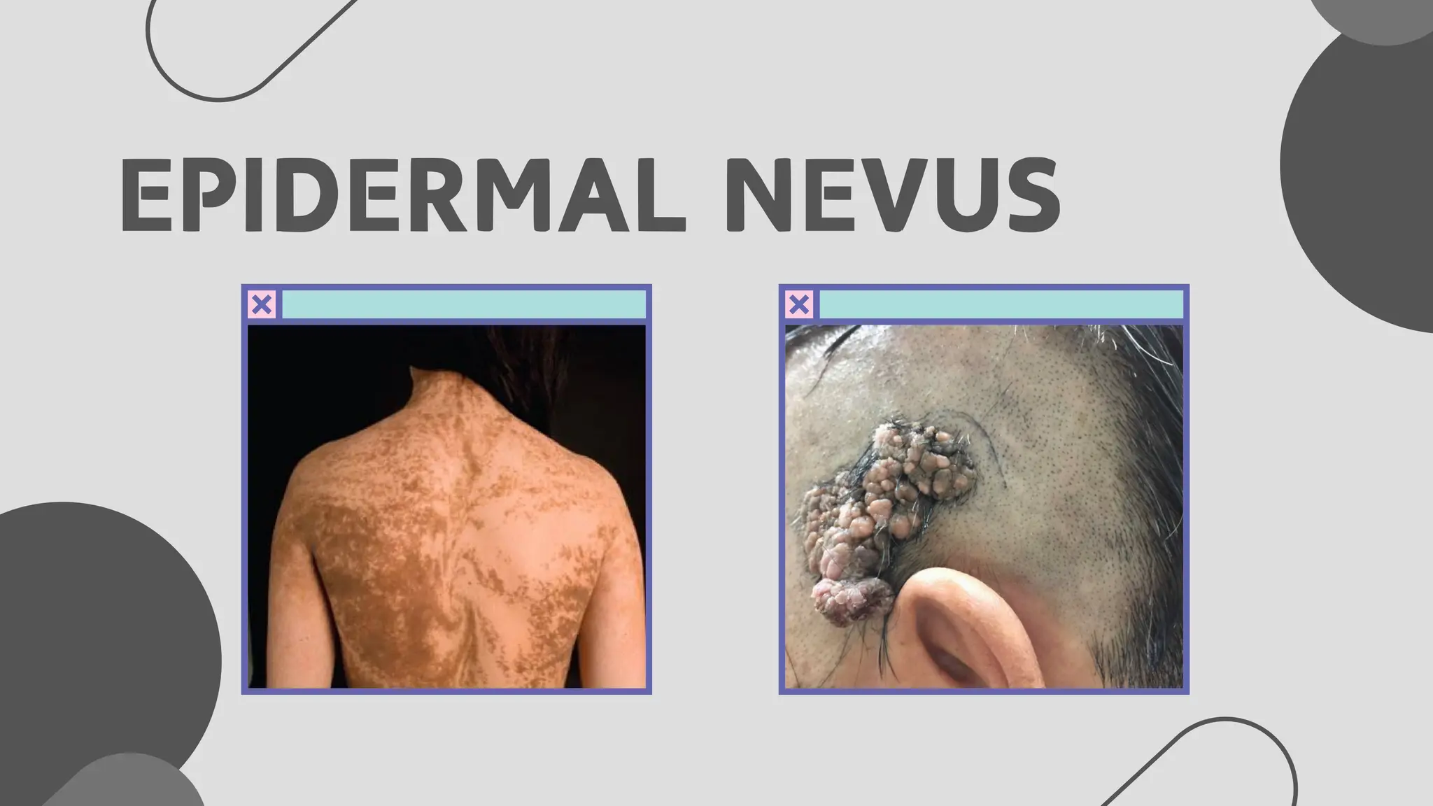 INTEGUMENTARY-SYSTEM-DEVELOPMENTAL-DEFECTS.pdf