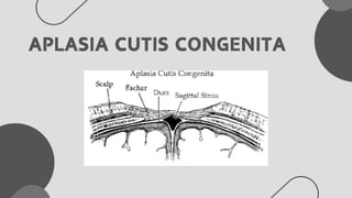 INTEGUMENTARY-SYSTEM-DEVELOPMENTAL-DEFECTS.pdf