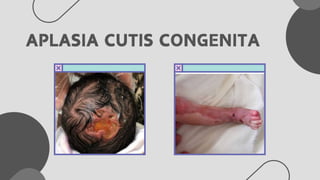 INTEGUMENTARY-SYSTEM-DEVELOPMENTAL-DEFECTS.pdf