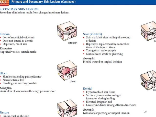 Integumentary disorders.ppt | Hair Care | Beauty