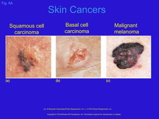 Integumentary Sys.ppt