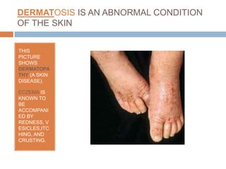 Integumentary System | PPT