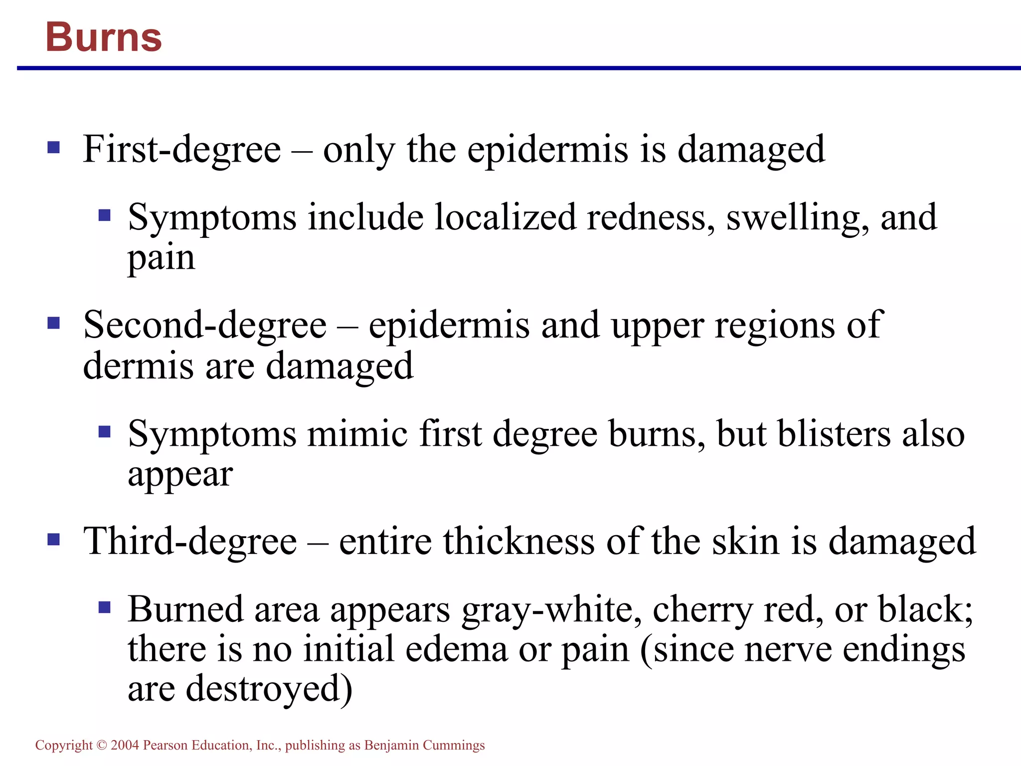 Integumentary system | PPT
