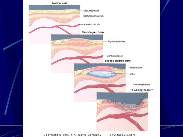 Chapter 4-- Integumentary system | PPT