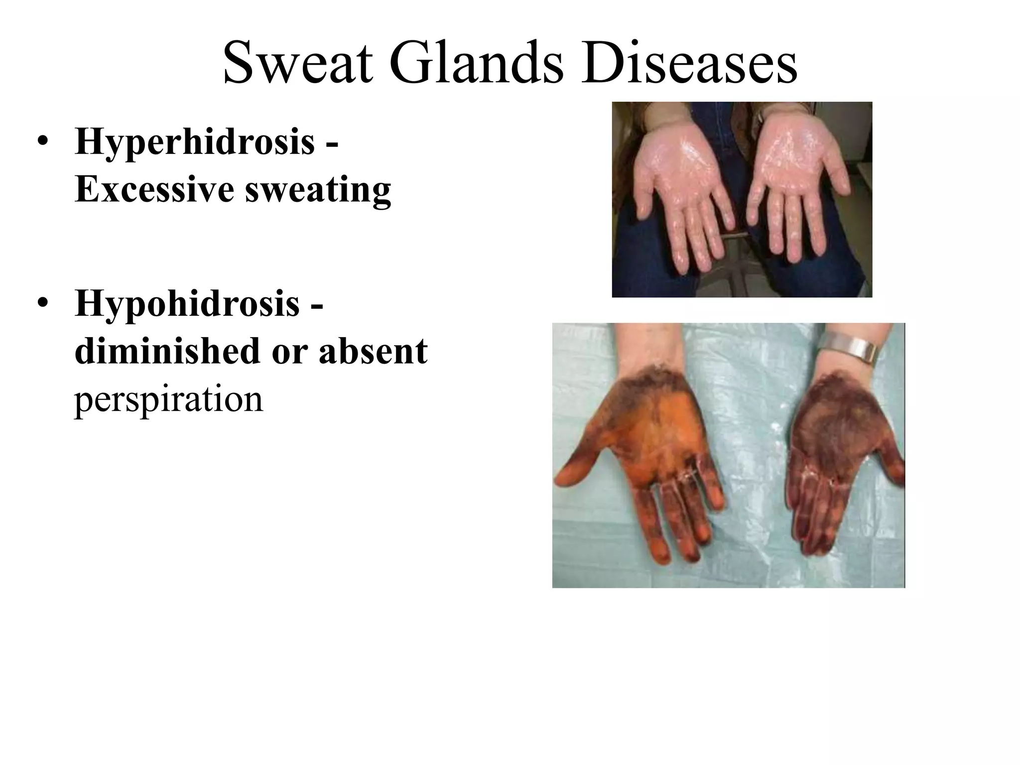 Integumentary system -mbbs.pptx