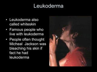 Integumentary system final | PPTX | Skin and Dermatology | Diseases and ...