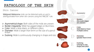 Integumentary system prep.pptx
